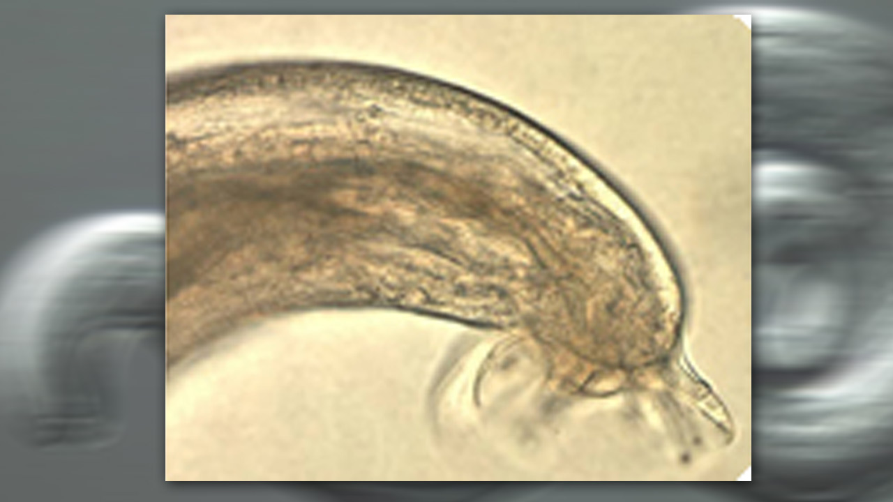 Reports Of New Brain Parasite On The Rise