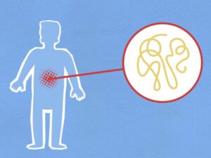 The Deadliest Diseases We Face Might Start With Inflammation